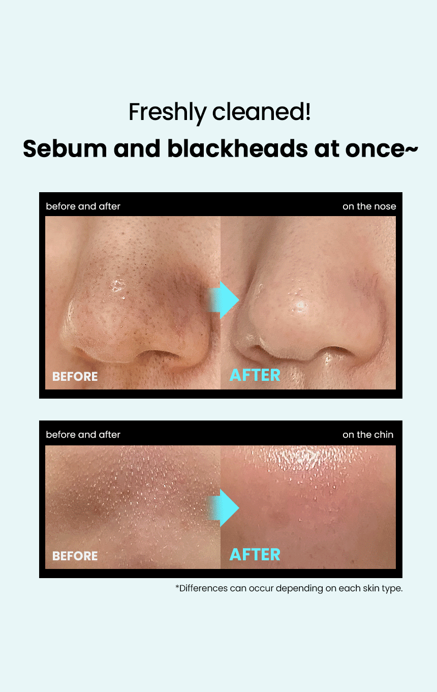 MUSINSA | ILSO Super Melting Sebum Softener 150ml + Deep Clean Master ...